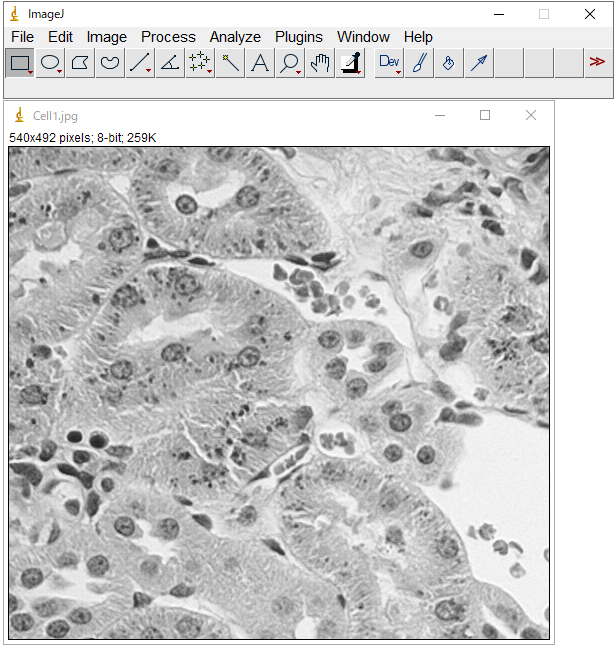 ImageJで細胞画像の解析してみました｜MiVLog（ミブログ）