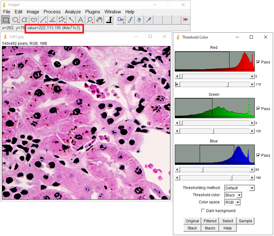ImageJで細胞画像の解析してみました｜MiVLog（ミブログ）