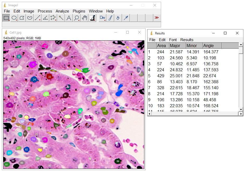 ImageJで細胞画像の解析してみました｜MiVLog（ミブログ）