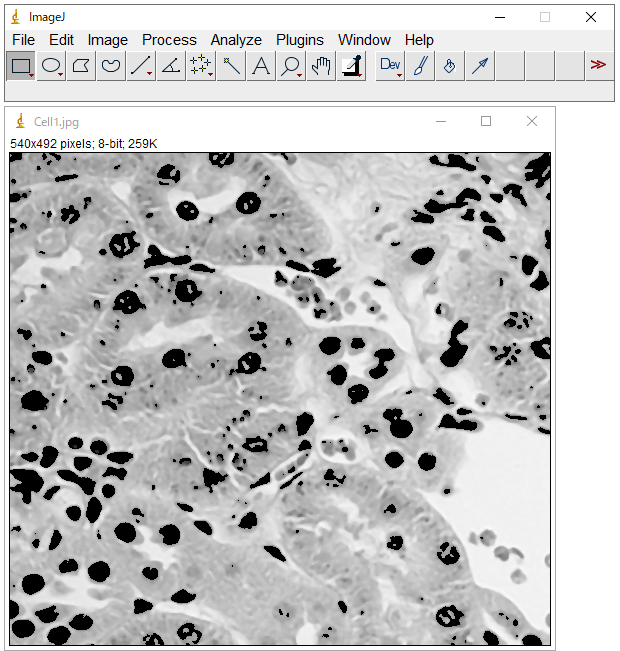 ImageJで細胞画像の解析してみました ～応用編～｜MiVLog（ミブログ）