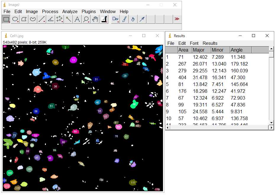 ImageJで細胞画像の解析してみました ～応用編～｜MiVLog（ミブログ）