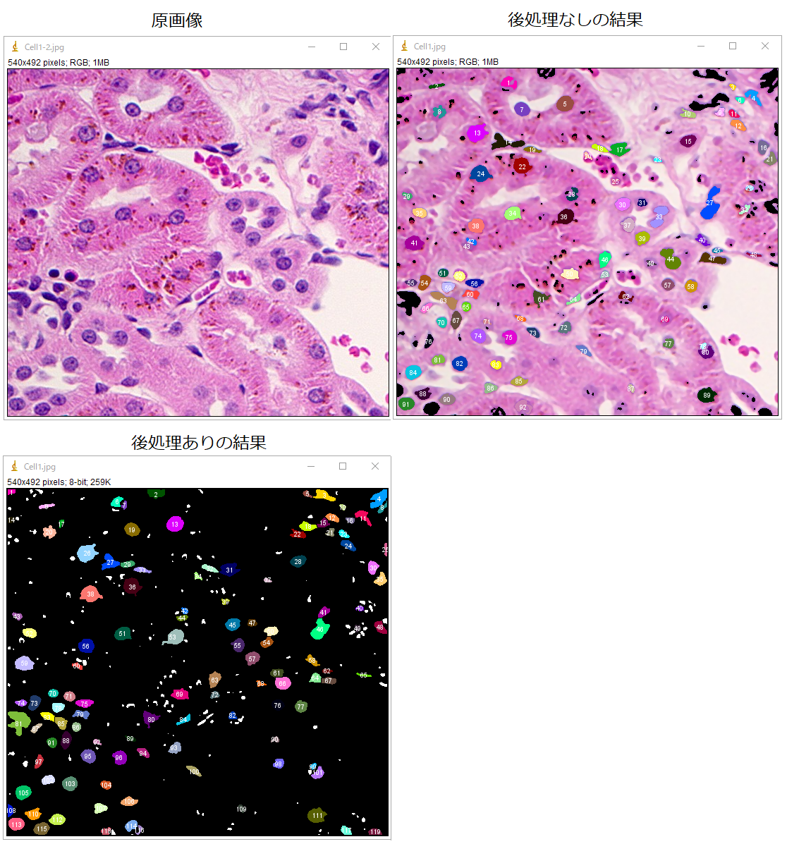 ImageJで細胞画像の解析してみました ～応用編～｜MiVLog（ミブログ）