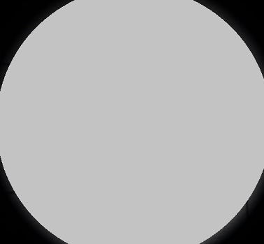 顕微鏡画像撮影における画角(FOV)の考え方と計算方法｜MiVLog（ミブログ）